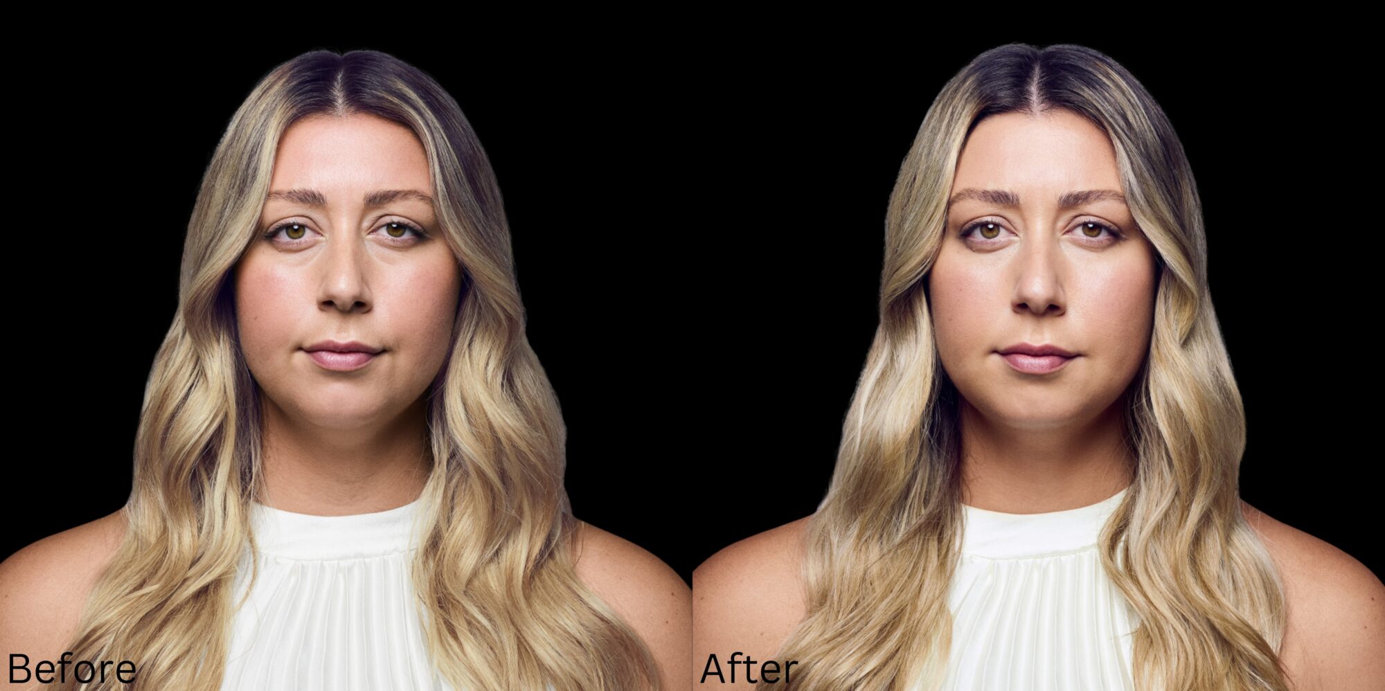 RHA Collection - Dr. Chernoff Plastic Surgery